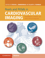 【预订】Pearls and Pitfalls in Cardiovascula...