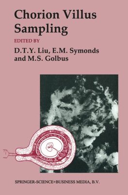 【预订】Chorion Villus Sampling