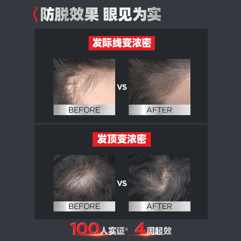 Alpecin德国欧倍青C1洗发露控油洗头头水女男咖啡因洗发水