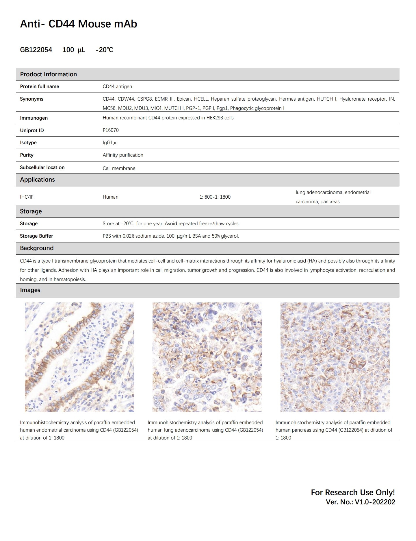 Servicebio抗CD44小鼠单克隆抗体 Anti-CD44 Mouse mAb,GB122054_虎窝淘