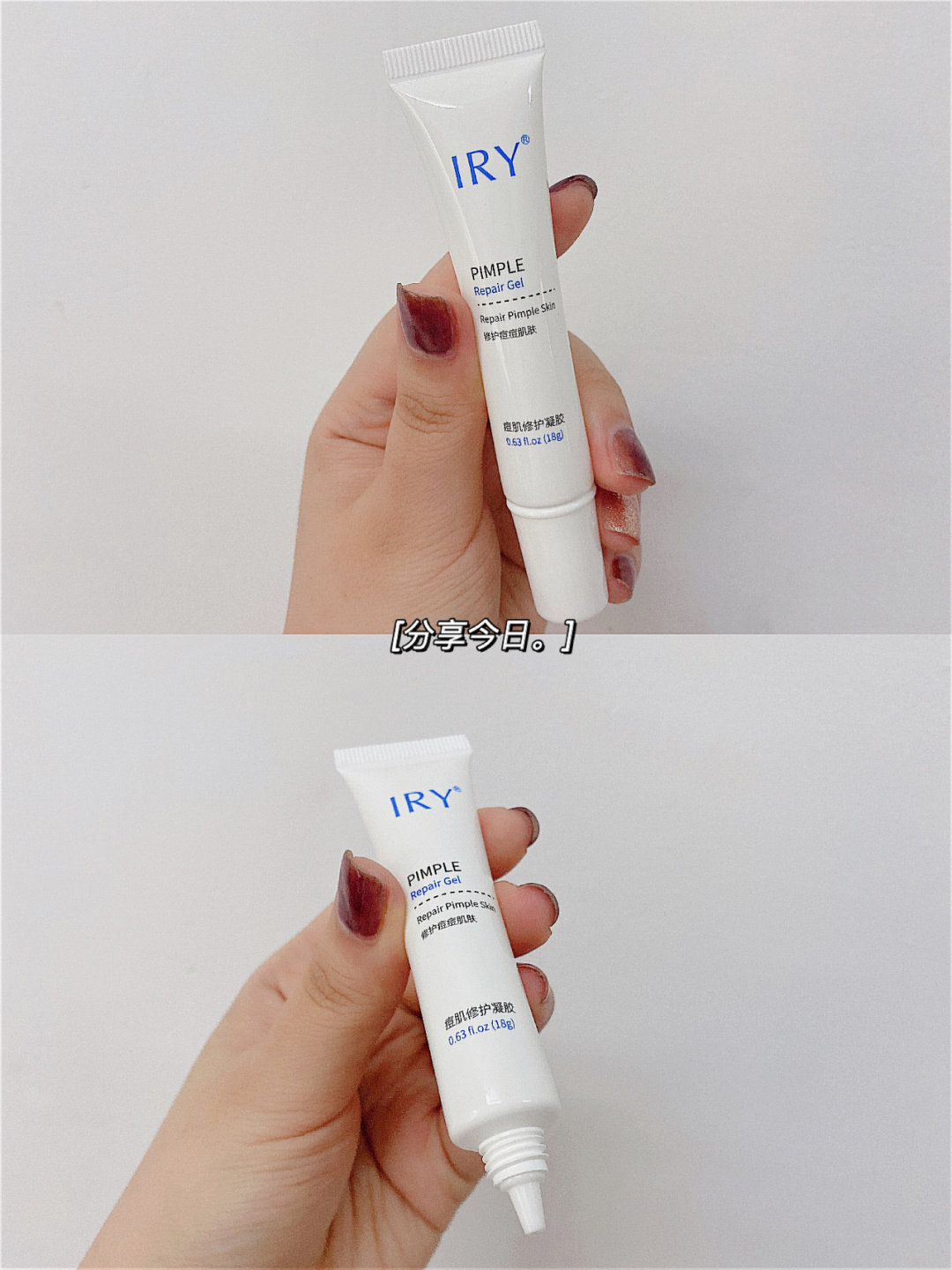 IRY祛痘凝胶去粉刺闭口凹洞淡化痘印痘疤控油水杨酸痘肌修护正品_虎窝淘