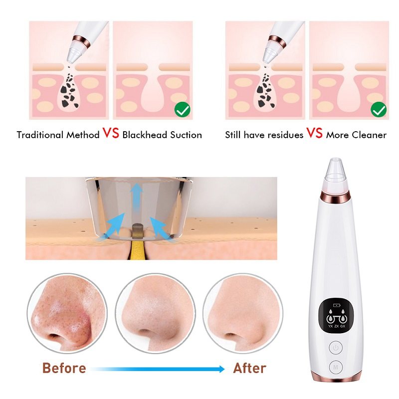 Blackhead Remover Nose Vacuum Suction Machine Face Clean_虎窝淘