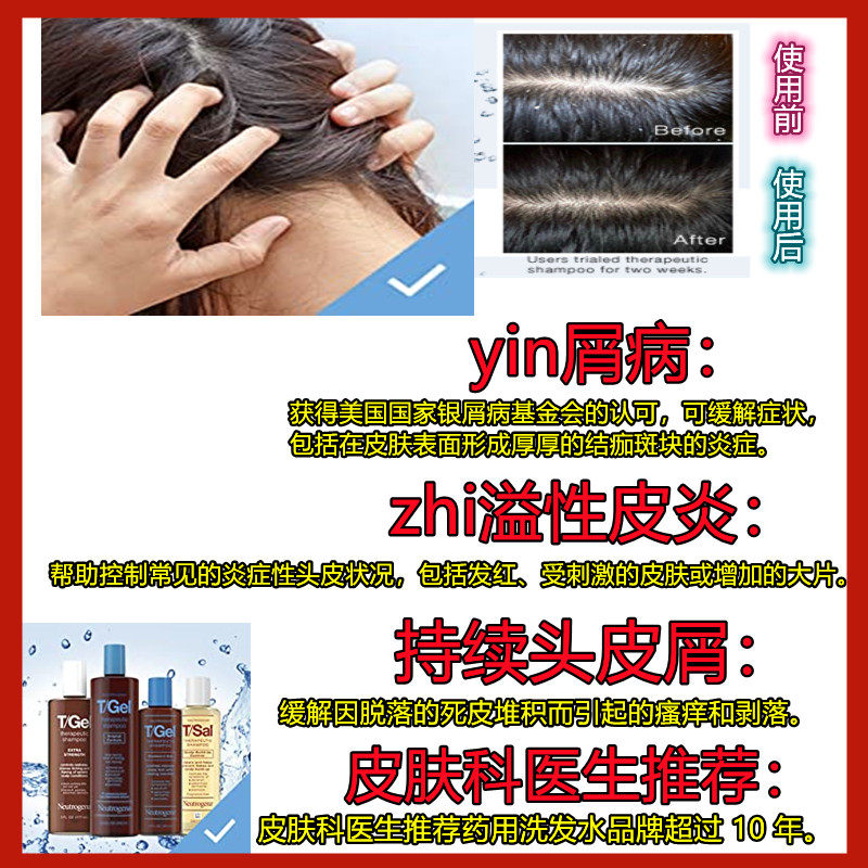 美英版Neutrog露得清gel煤焦水杨去屑止痒控油蓬松热销脂溢洗发水_虎窝淘