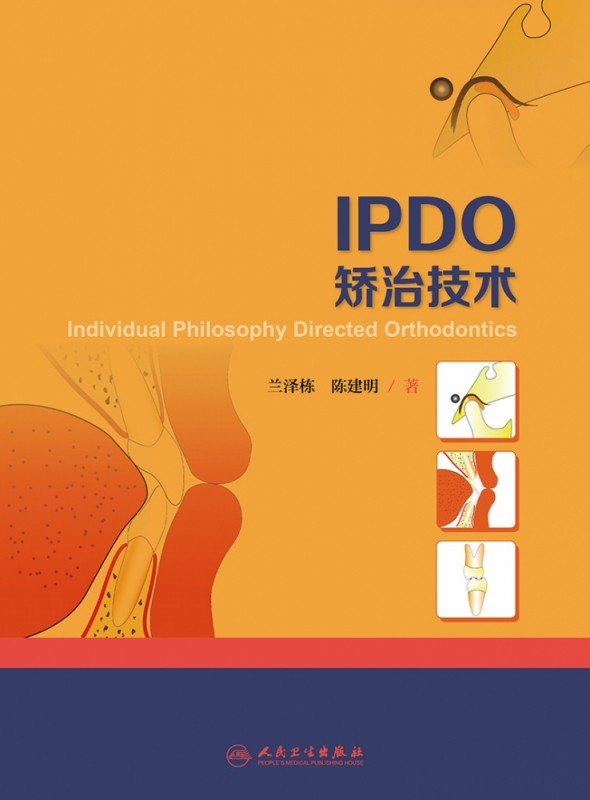 IPDO矫治技术博库网_虎窝淘
