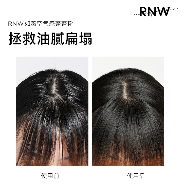 RNW RNW