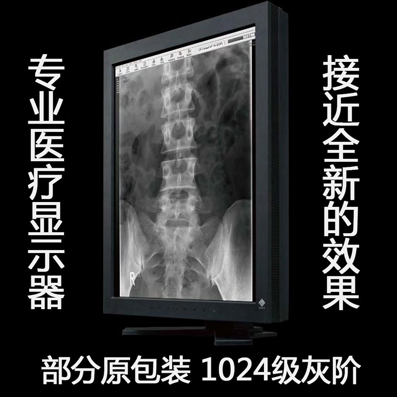 医疗医学EIZO艺卓灰阶黑白显示器监视器GS220/GS320/520 B超CR/CT