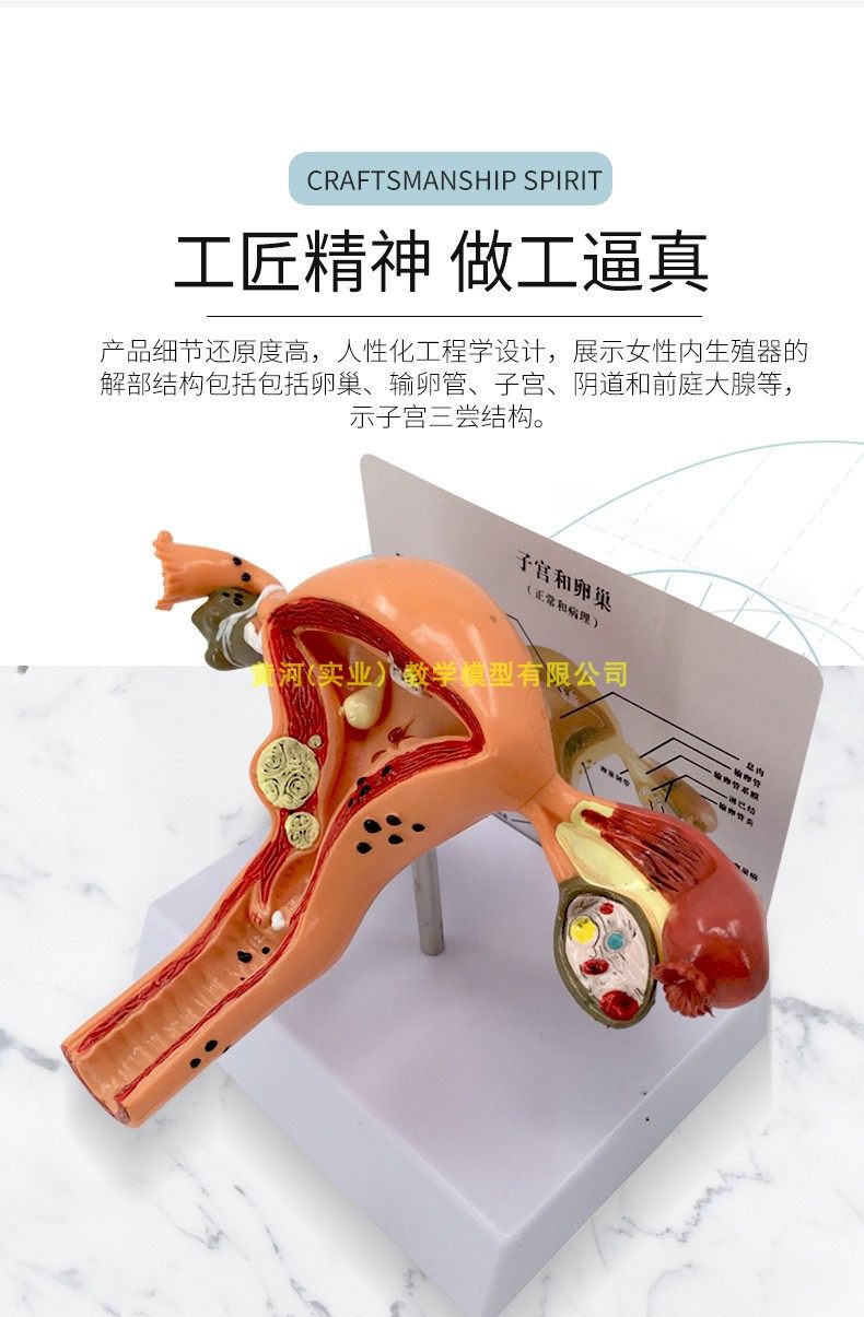 Simulation of female models of common human uterine and ovarian ...