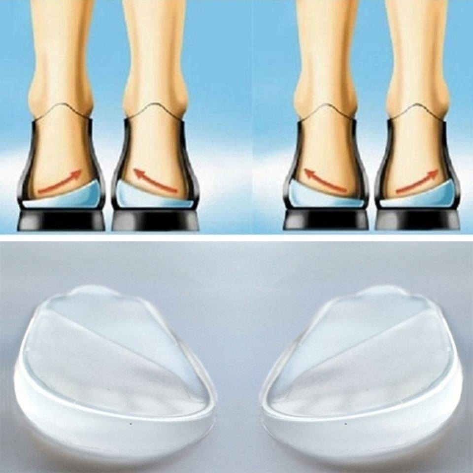 [USD 7.43] o-shaped leg orthosis straight leg sockliner o-shaped leg xo ...