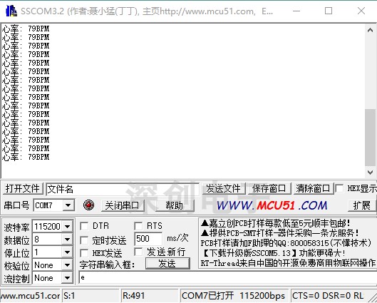 ADS1292模块 心电呼吸信号测试模块-阿里巴巴