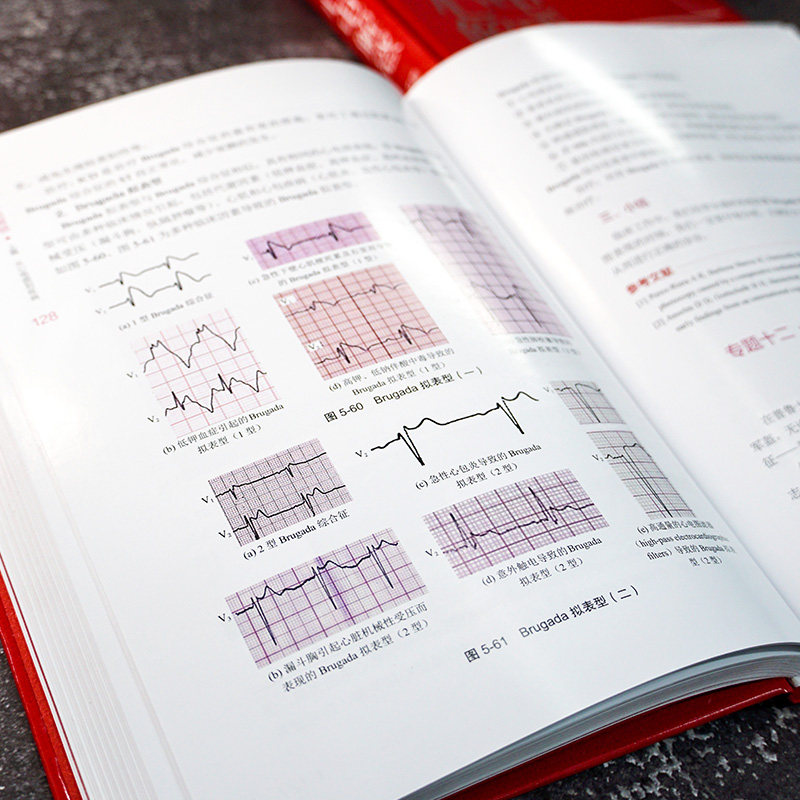 [USD 46.50] ECG confusion Zhao Yuntao ECG book entry clinical ...