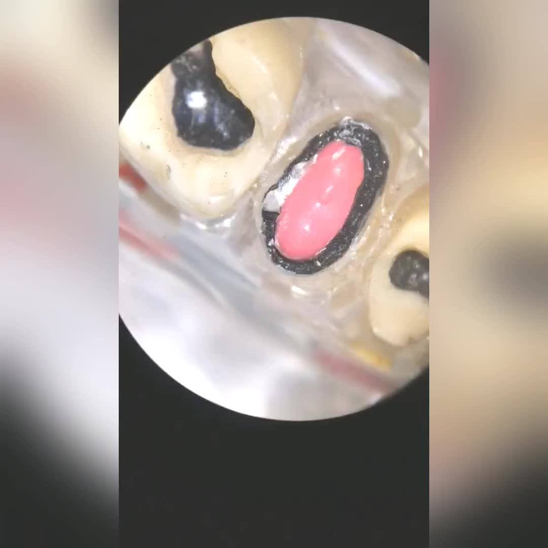 China Dental Operating Microscope Endodontie Oral Stereo Dental Digital ...