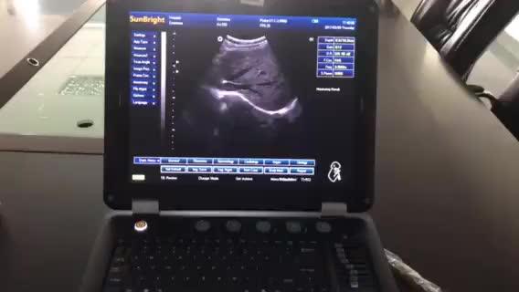 Pregnancy Ultrasound Portable Ultra Sound Machine - Buy Ultrasound ...