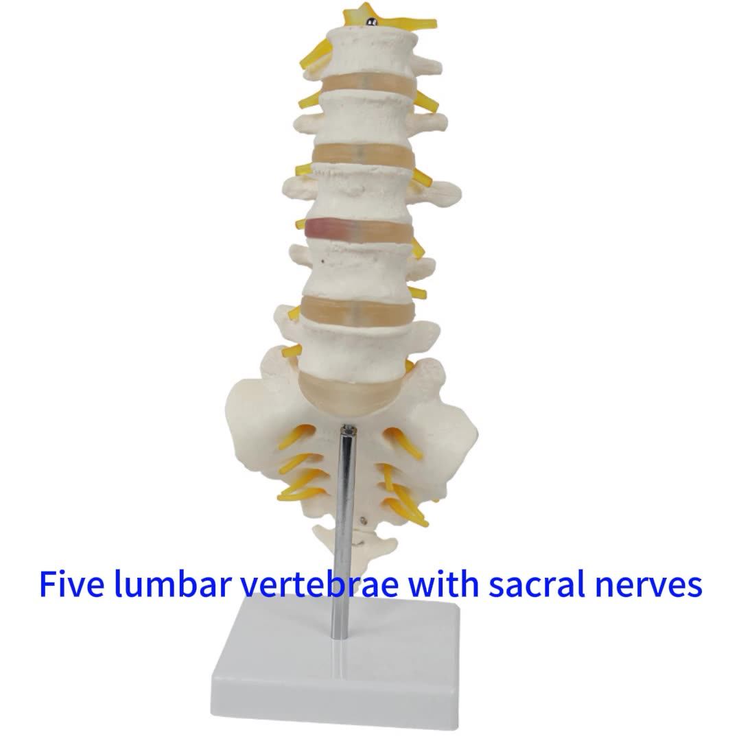 Medical Teaching Lumbar Vertebrae With Sacrum & Coccyx And Herniated ...