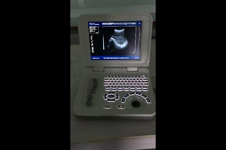 Super Professional New Cheapest Portable B Scan Ultrasound Machine Sun ...