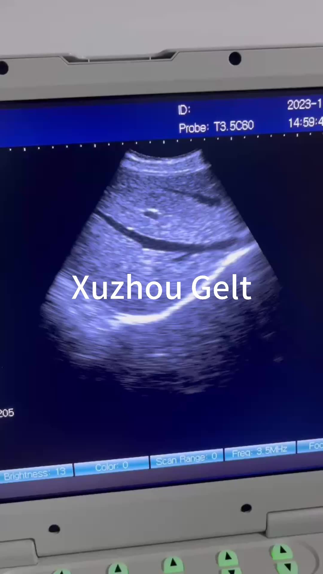 Cardiac Probe Echographe Doppler Color Doppler Portable Ultrasound ...