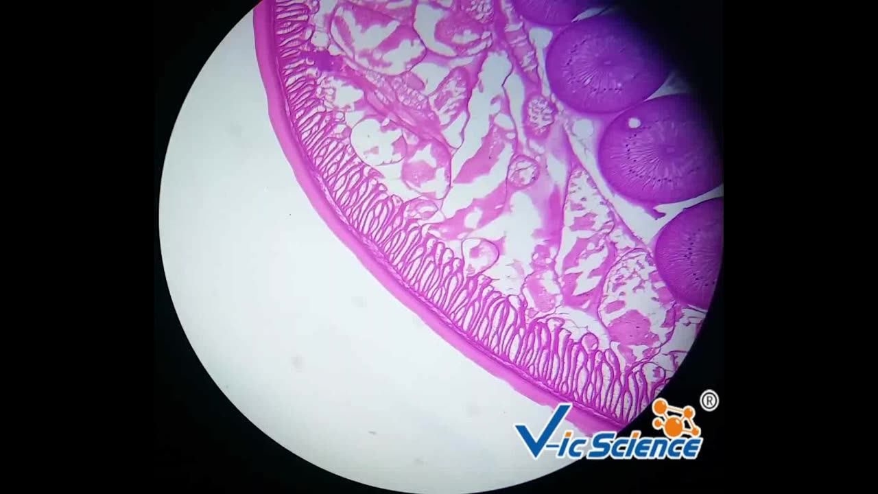 Animal Parasite Amoeba Louse Prepared Slides Medical Science ...