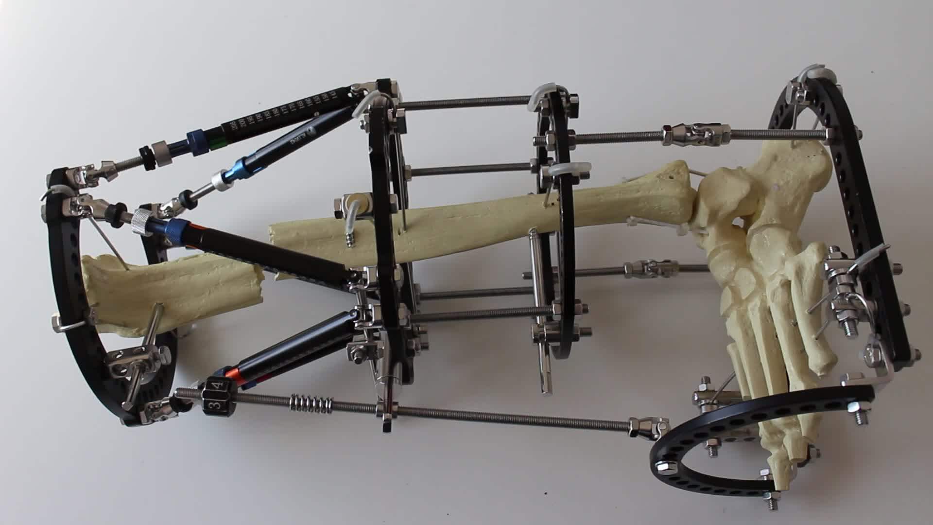 Orthopedic Instruments Ilizarov/hoffman/taylor/peek Radiolucent ...