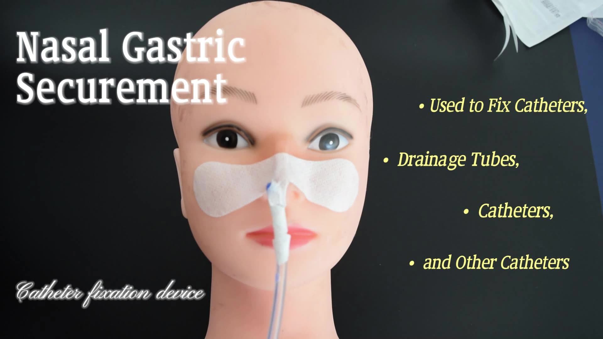 Nasogastric Tube Catheter Fixation Device Nasal Tube Fix Tape China ...