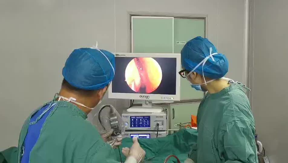 Laparoscopy Hd Camera System 4k Uhd 3cmos Operation Endoscopy Camera ...