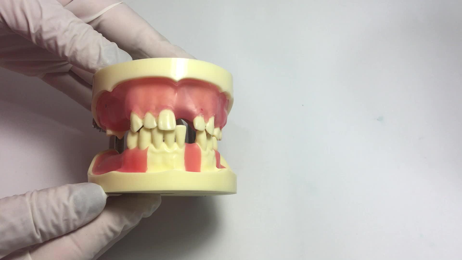 Edentulous Implant Practice Model With Soft Gum For Cutting,Suturing ...