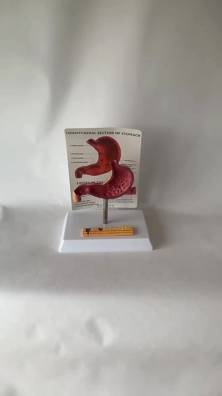 Anatomical Model Special Section Model Of Chronic Pathological ...