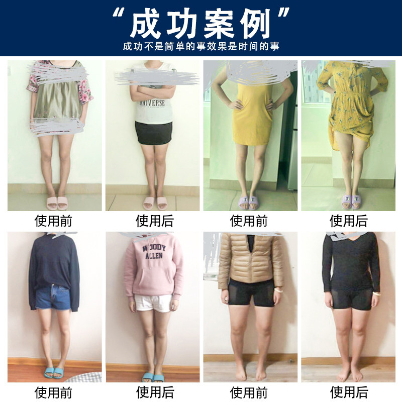 [USD 32.80] (Watson's recommendation) Correcting the O-leg x-leg xo-leg ...