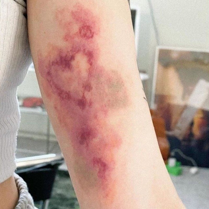 Love bruises and diseases aesthetic tattoo stickers for women are ...