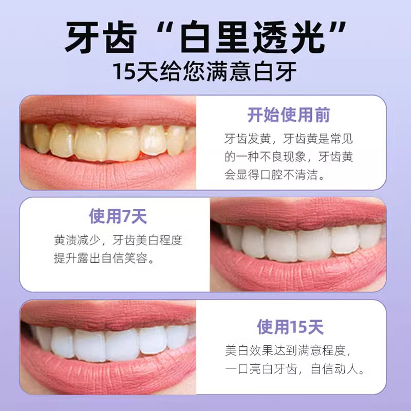 Degaba美牙仪官方正品：蓝光美白牙齿神器！告别黄牙逆袭冷白皮笑容！-牙齿美白仪-淘宝好物网