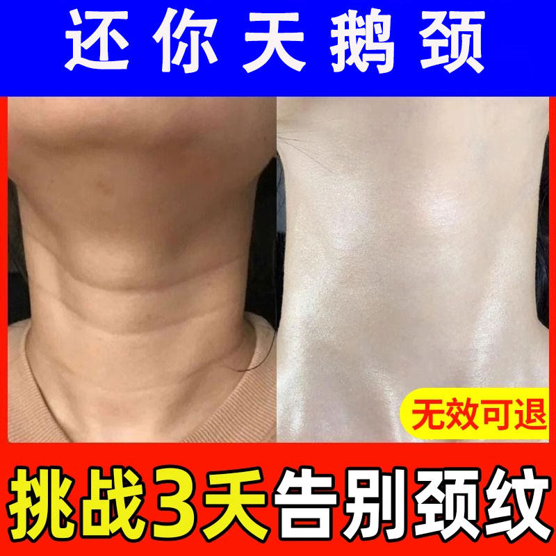 Neck cream and neck wrinkle lifting artifact, let your swan neck no ...