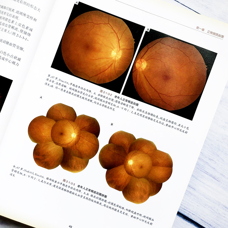 [USD 51.62] Fundus Photography Skills and Color Mapping Interpretation ...