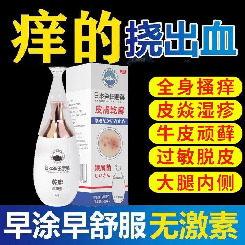 A must-buy for 25 years! japanese imported anti-itch cream tested ...