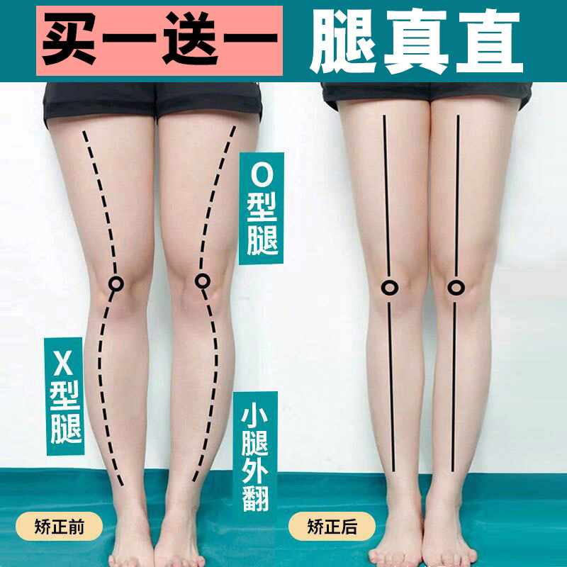 [USD 32.80] O leg straight leg insoles O-leg xo-type leg straighteners ...