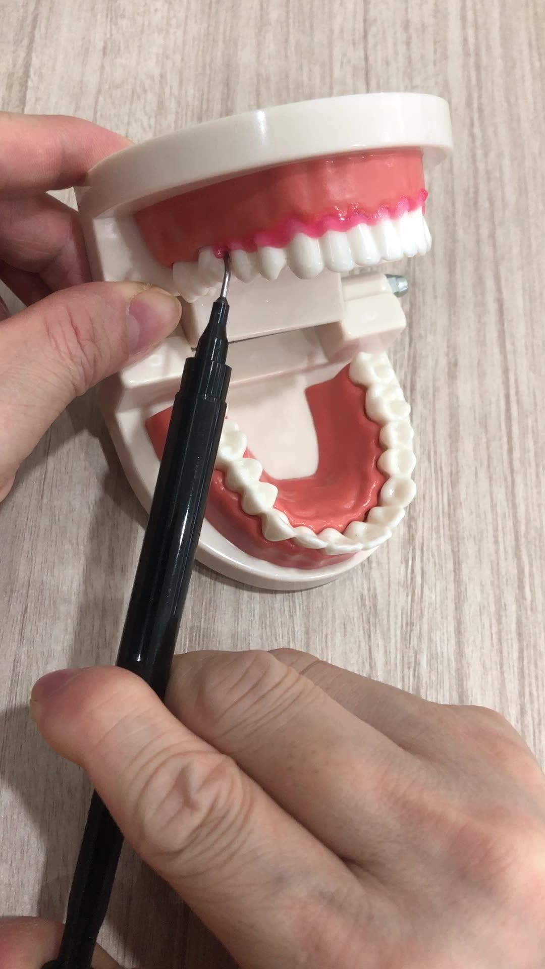 Professional Teeth Whitening Gingival Barrier Dental Gum Dam Gum ...