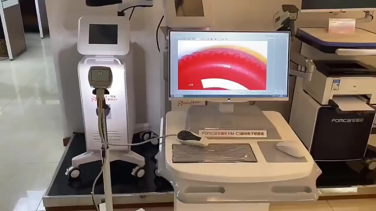 Colposcope Digital Imaging System Gynecological Colposcopy Camera ...