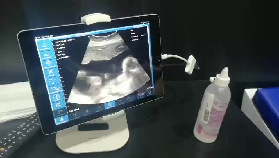 2019 Latest Wireless Type Ultrasound Probe Scanner Many Models To ...