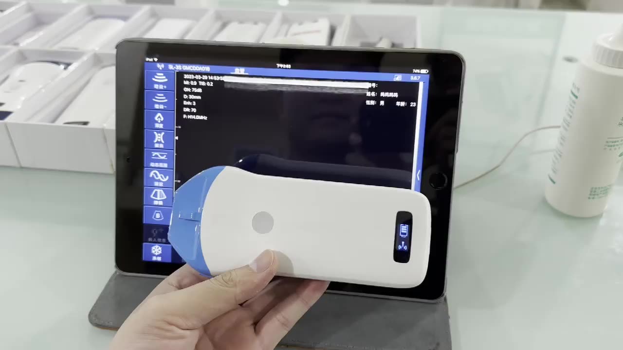 Sonostar Portable Wireless Bw Linear Picc Ultrasound Probe Electric ...