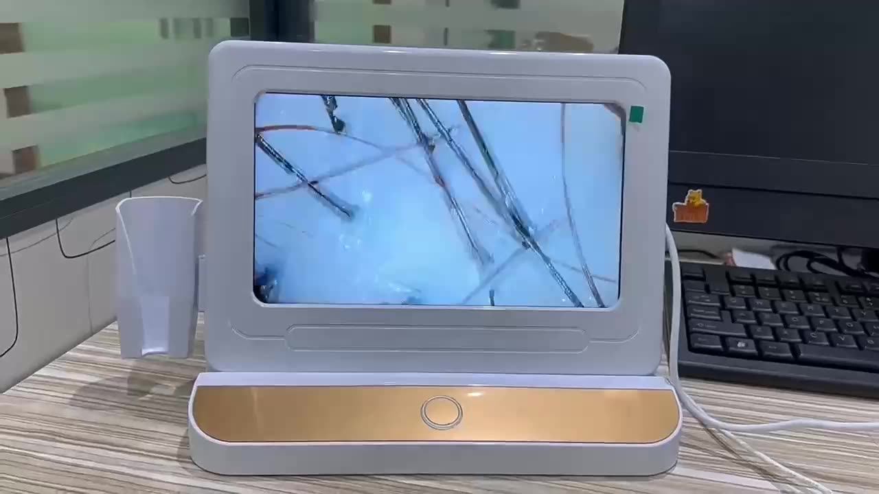 Portable Hd Hair Follicles Scalp Scanner Detector Hair Analyzer / Skin ...