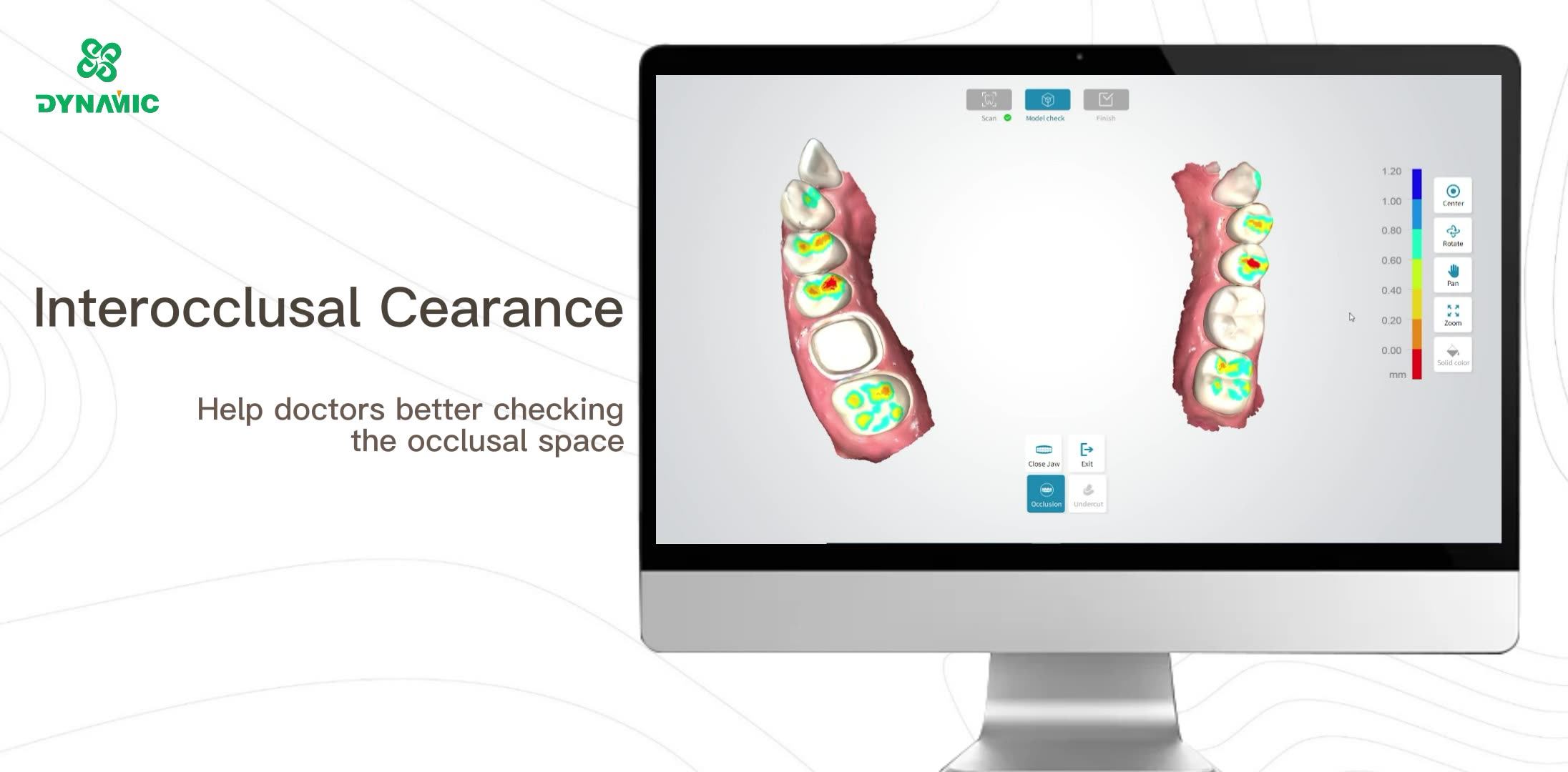 Chinese Intraoral Digital Dental 3d Scanner For Dentistry Ios Escaner ...