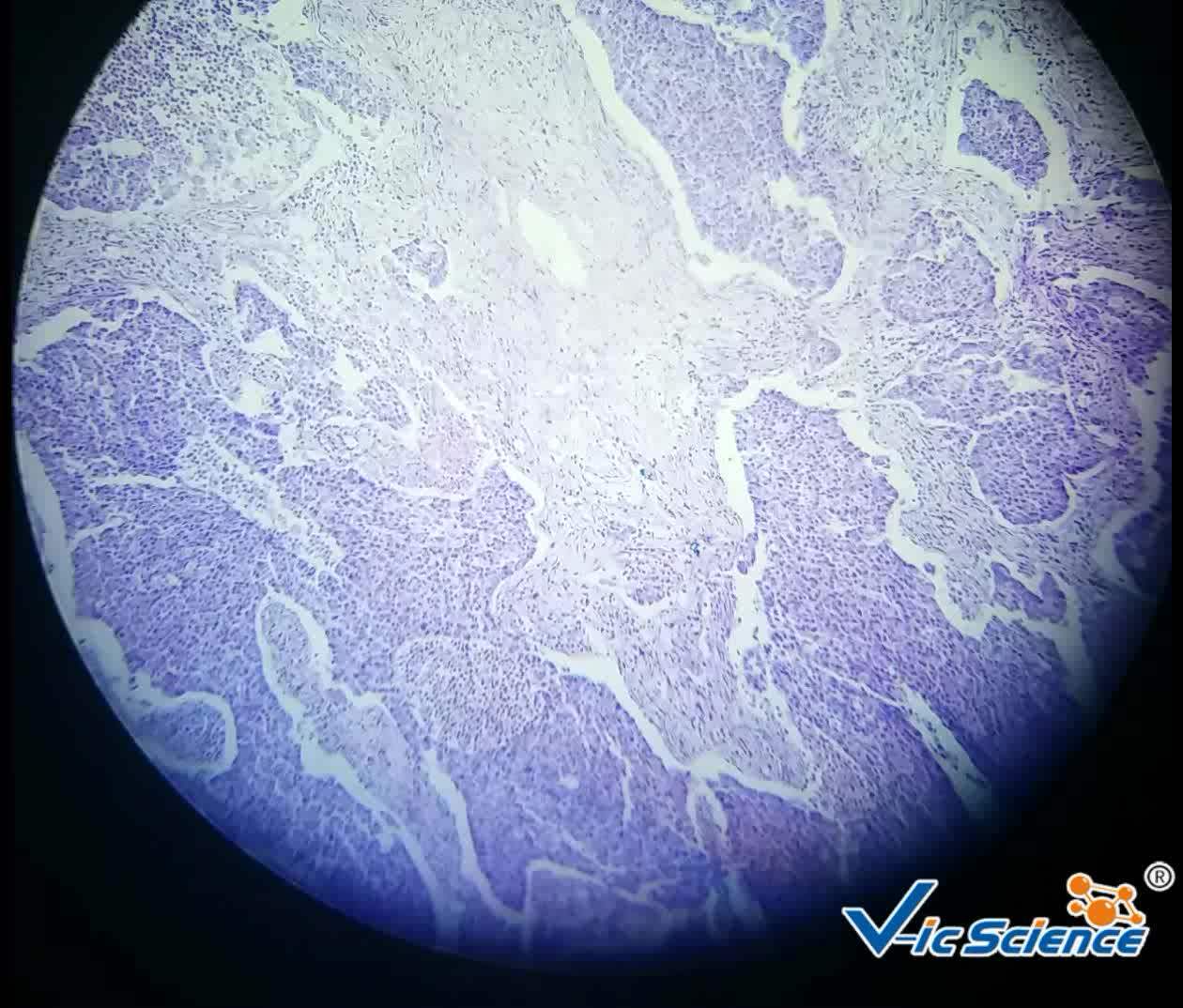 200pcs Human Pathology Slides For Medical Students - Buy Pathology ...