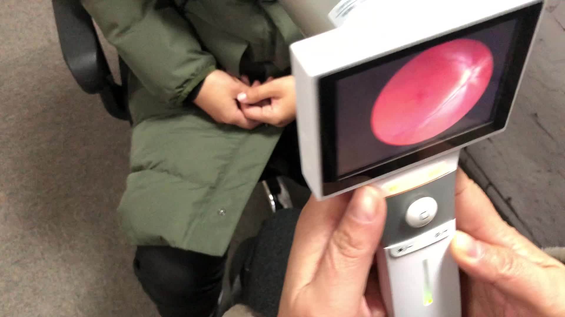 Handheld Digital Portable Eye Exam Fundus Camera Ophthalmic Fundus ...