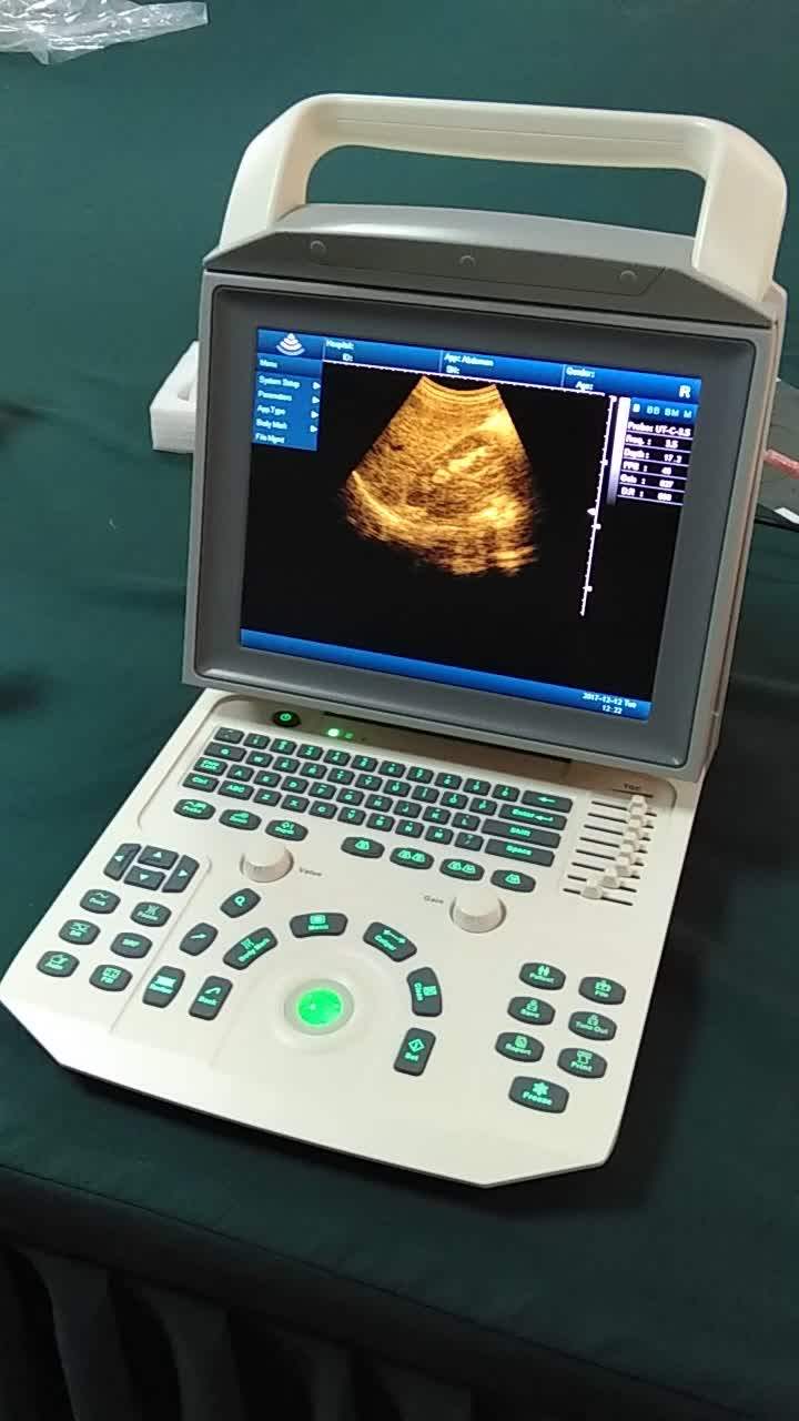 2018 New! Mslpu46 Ultrasound Machine,Ultrasound Scanner Manufacturer In ...