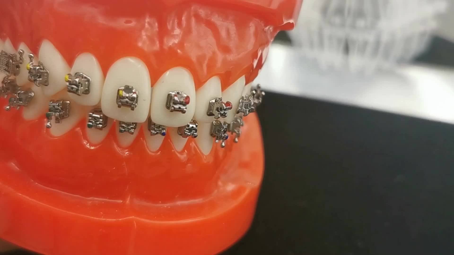 Guber Dental Top Sell Orthodontic Brackets 0.022 Roth Self-ligating ...