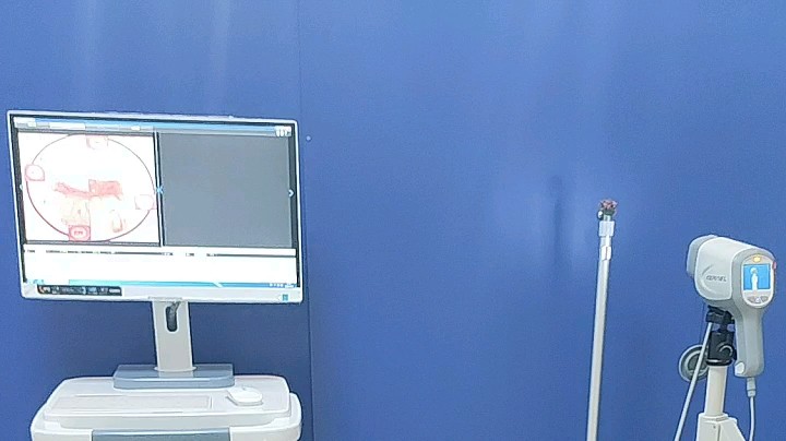 Full Hd Sony Camera Digital Video Colposcope Endoscopic Camera For ...