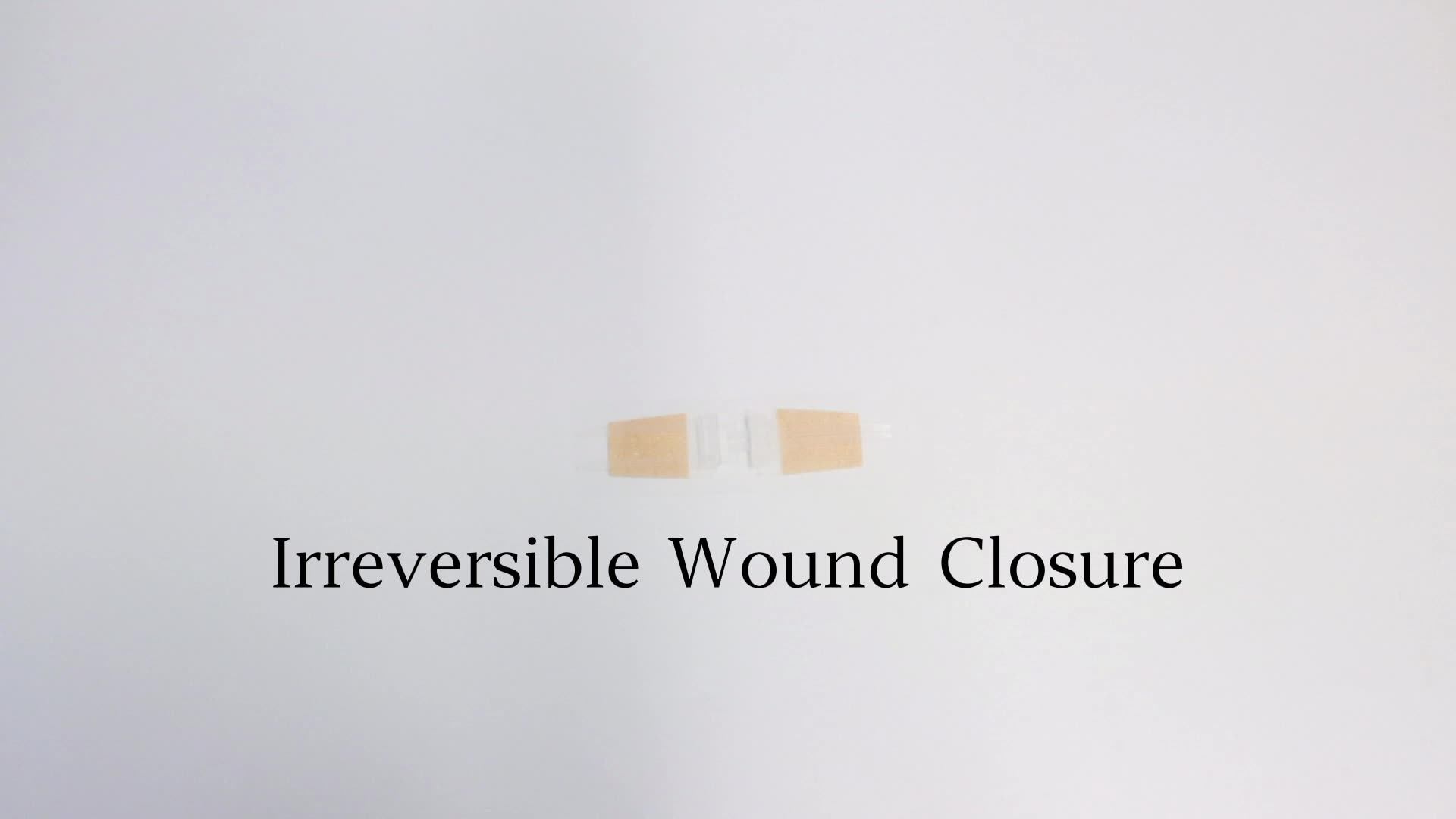 Bluenjoy New Arrival Epidermis Wound Closure Zipper Zip Stitch Sutures ...