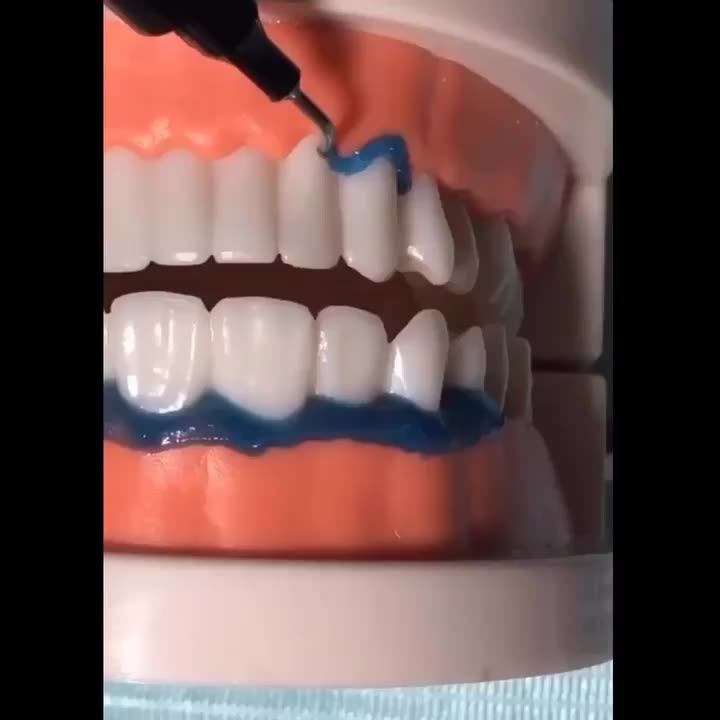 3ml Gingival Barrier Gum Protector Protection Gel - Buy Gingival ...