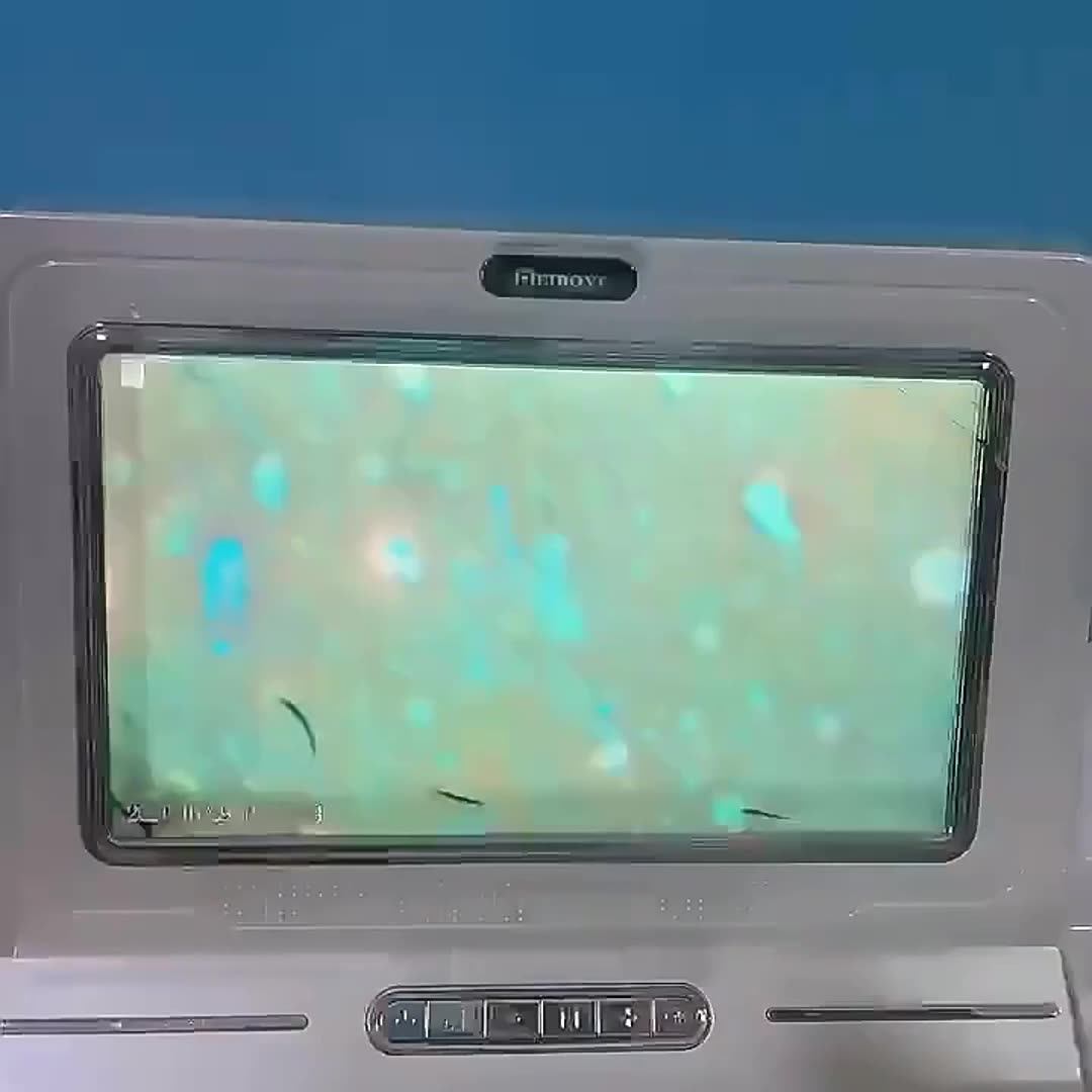 2024 Scalp Scanner Detector Hair Analyzer / Skin And Scalp Hair ...