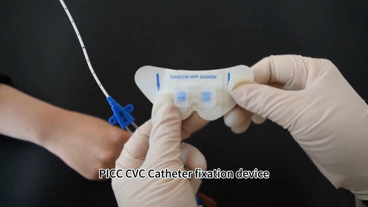 Medical Body Surface Catheter Fixation Device Disposable Picc Cvc Biliary Drainage Tube Fixing ...