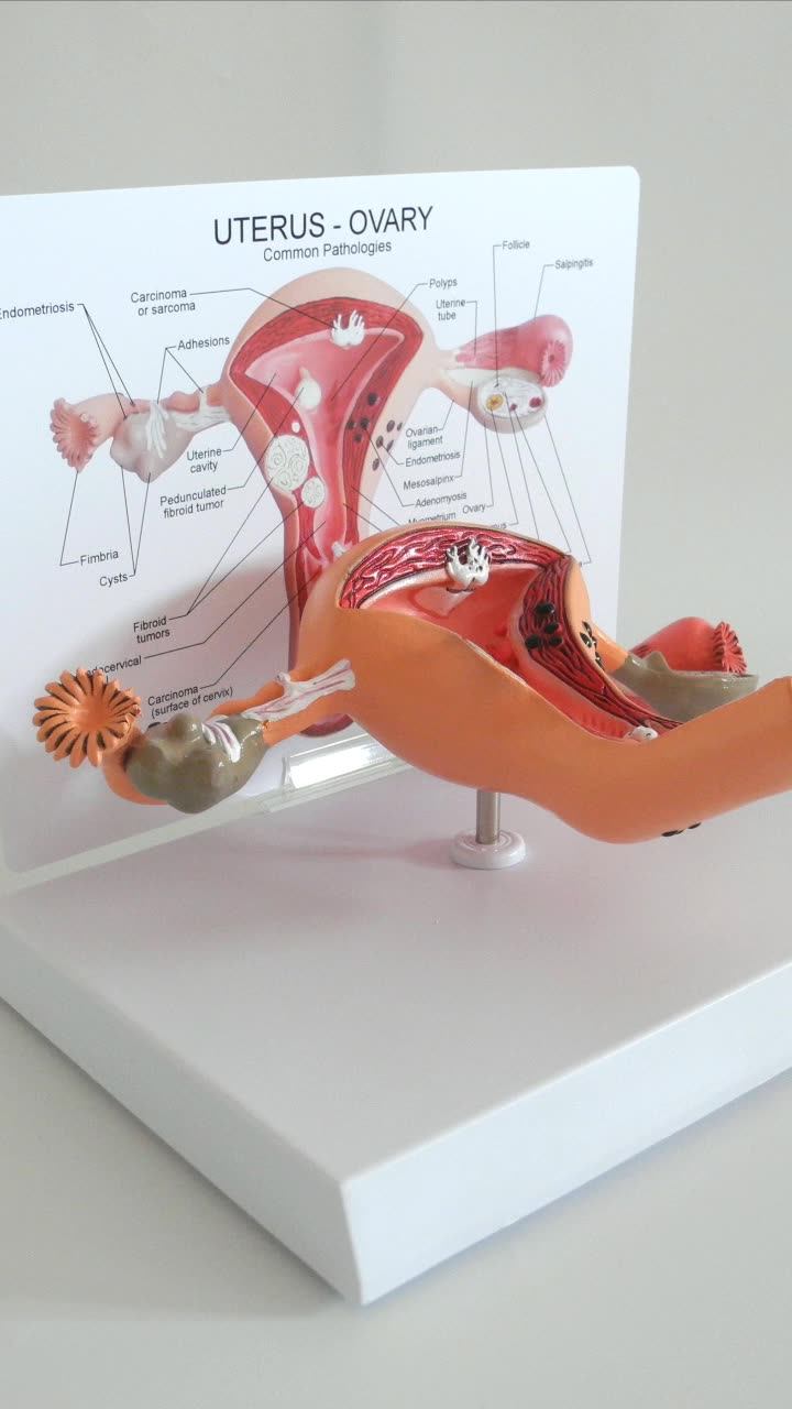 Medical Science Human Anatomical Pathology Uterus Education Model - Buy ...