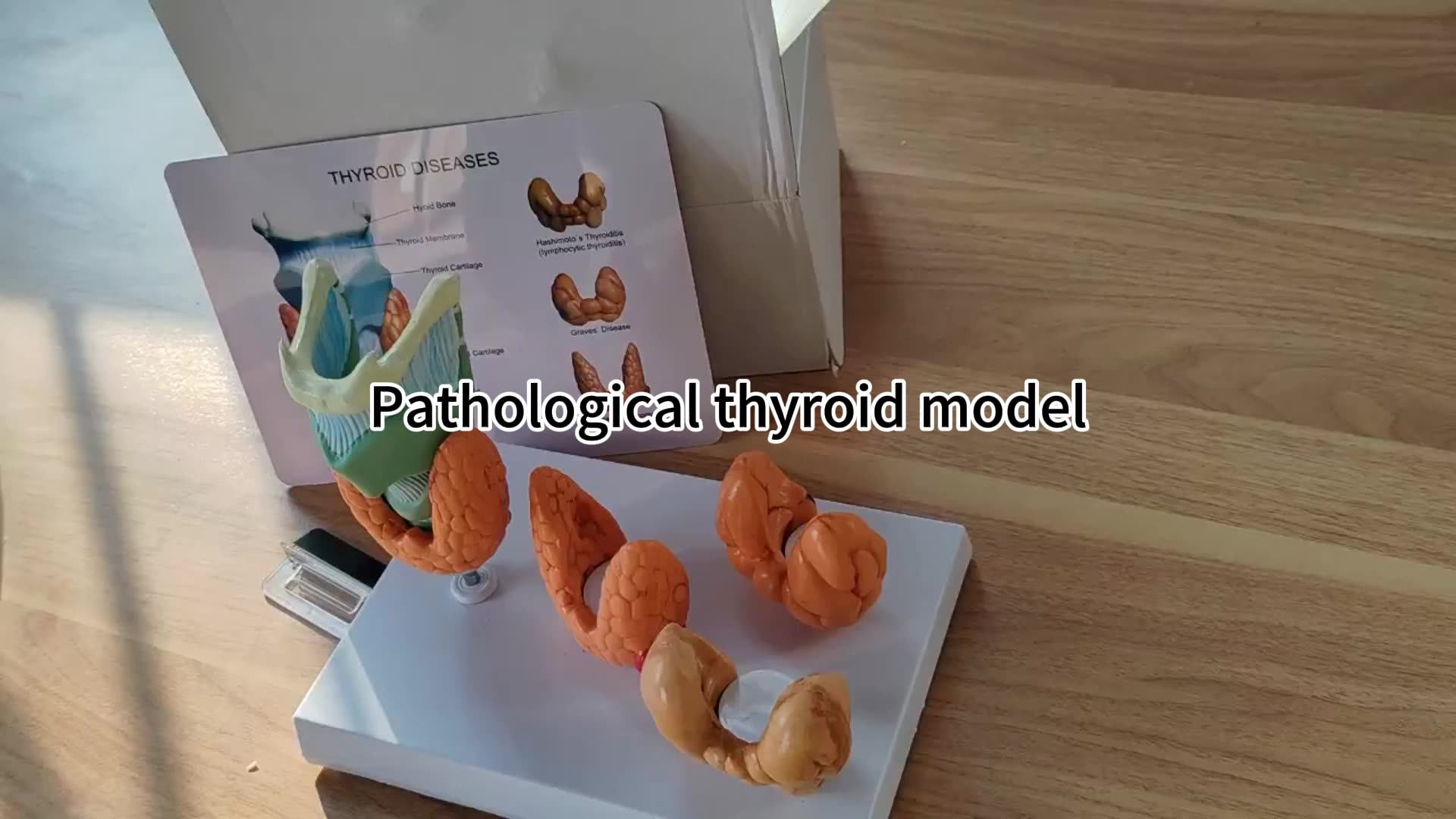 Medical Science Human Anatomy Larynx Pathology Thyroid Experimental ...