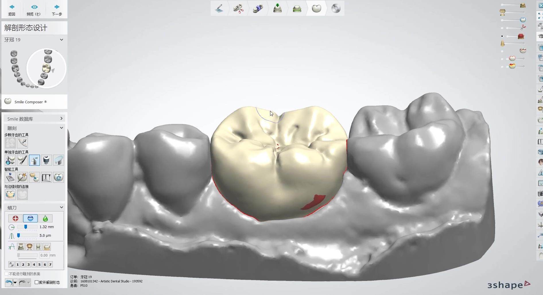 3Shape 2024全套软件+教程包：牙冠设计、导板修复与正畸模块，轻松搞定口腔数字化-加密狗-淘宝百科网